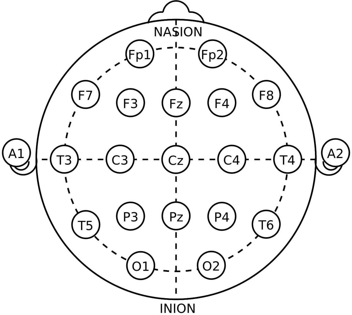 Brain Mapping for TMS Treatment: The New BEAM Method | Madison Avenue ...