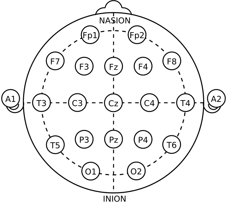 Brain Mapping for TMS Treatment: The New BEAM Method | Madison Avenue ...